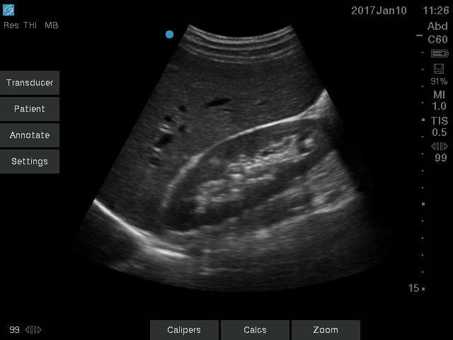 Sonosite SII | Fujifilm Sonosite